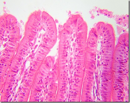 Biogenmol: El intestino delgado